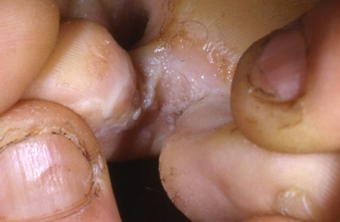 Fig. 4
