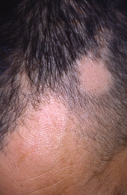 Fig. 3