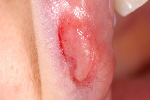 Fig. 6