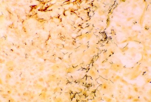 Fig. 10