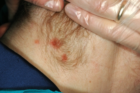 Fig. 1