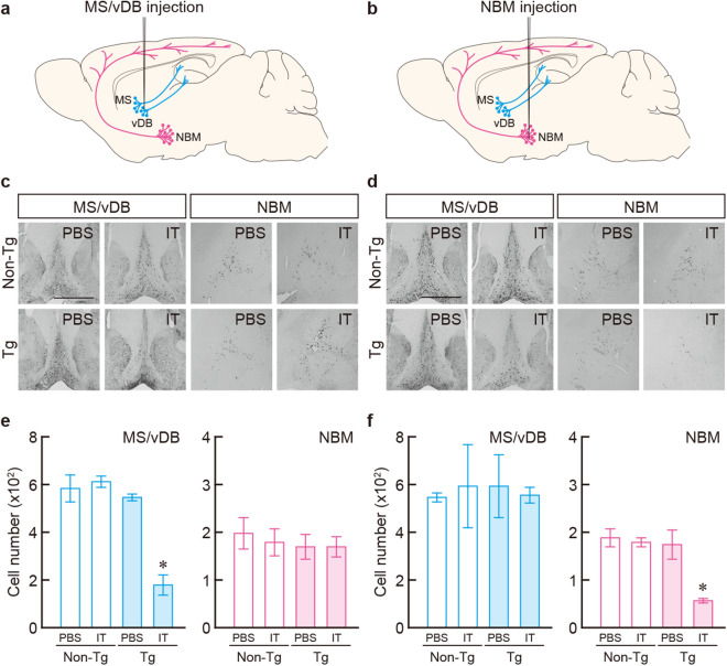Different cholinergic cell groups in the basal forebrain regulate social interaction and social ...