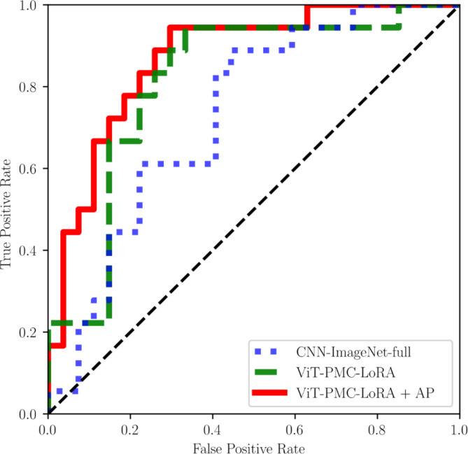 Augmented prediction of vertebral collapse after osteoporotic vertebral compression fractures ...