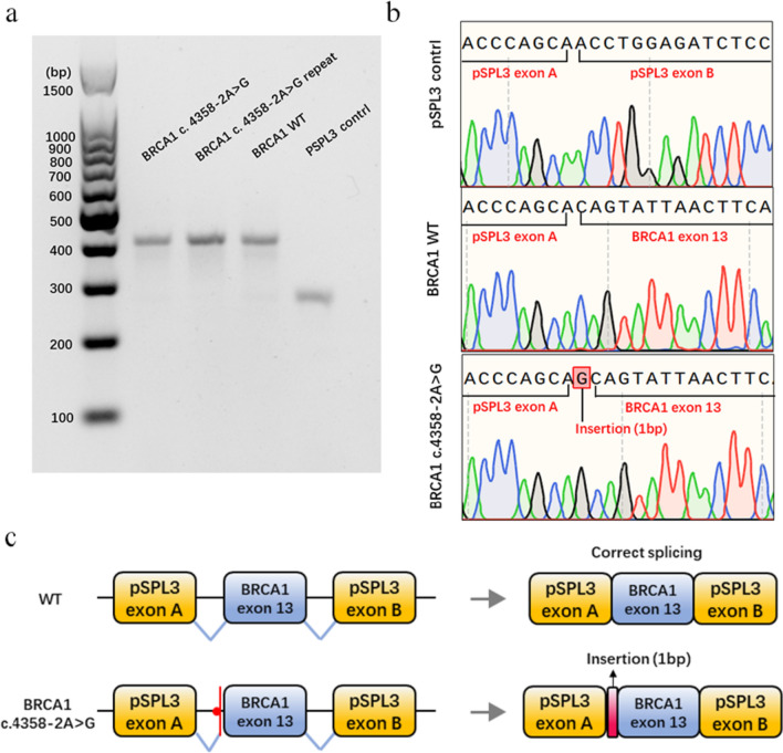 Reclassifying BRCA1 c.4358-2A > G and BRCA2 c.475 + 5G > C variants ...
