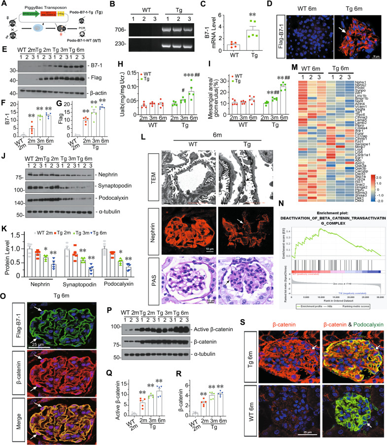 B7-1 mediates podocyte injury and glomerulosclerosis through ...