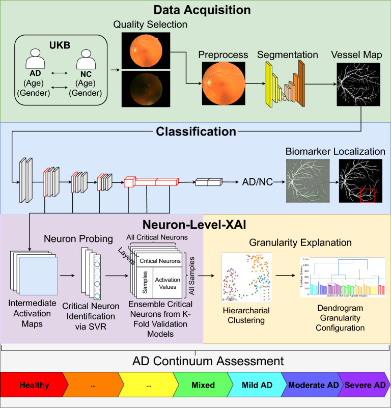 Neuron-level explainable AI for Alzheimer’s Disease assessment from fundus images - PMC