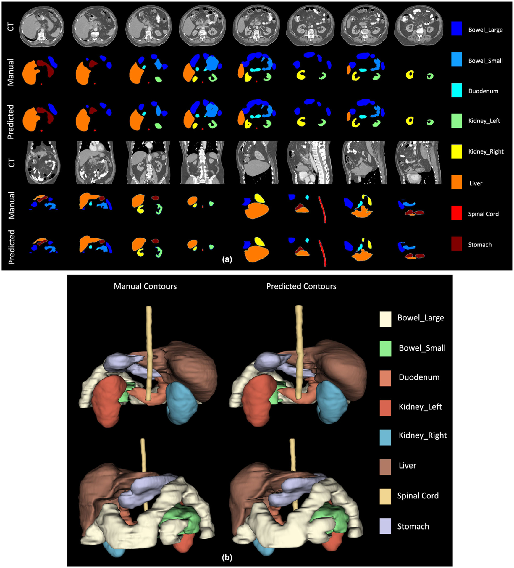 CT-based multi-organ segmentation using a 3D self-attention U-net network for pancreatic ...