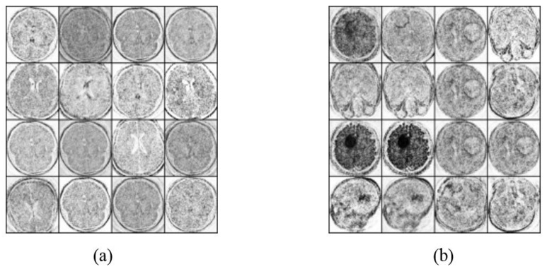 BrainGAN: Brain MRI Image Generation and Classification Framework Using ... BrainGAN: Brain MRI Image Generation and Classification Framework Using ...