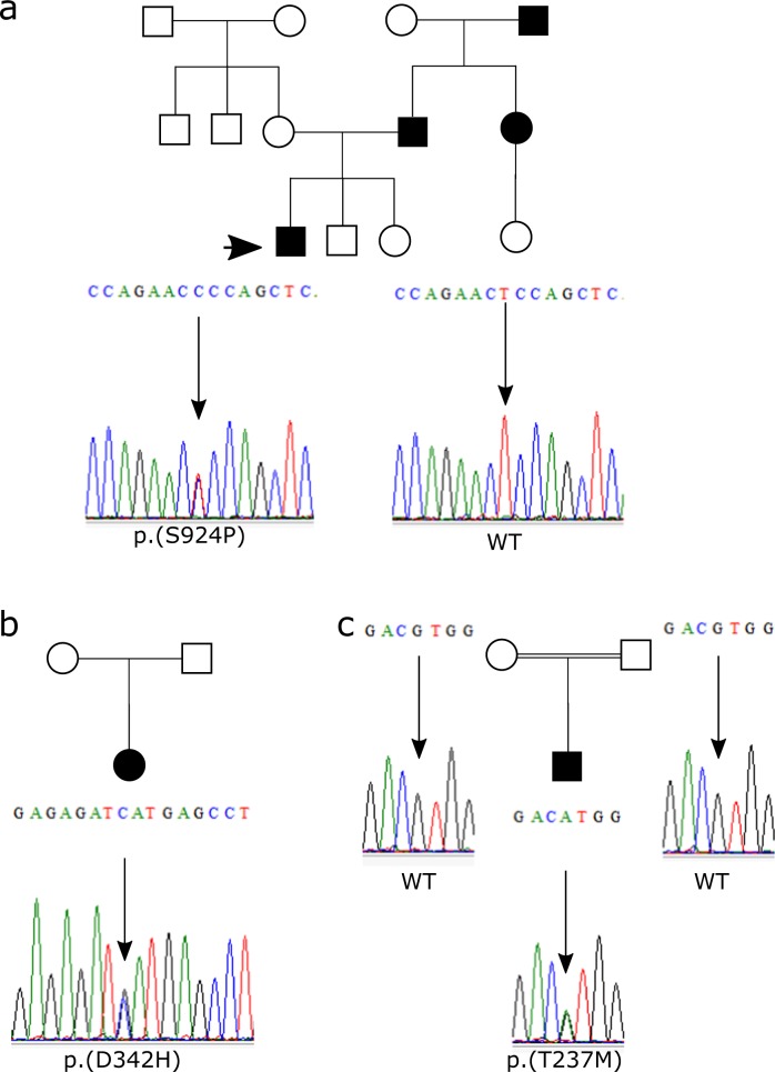 Rare missense variants in the ALPK1 gene may predispose to periodic fever, aphthous stomatitis ...