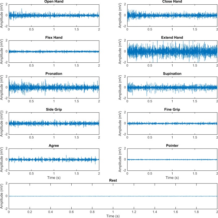 Evaluation of surface EMG-based recognition algorithms for decoding hand movements - PMC