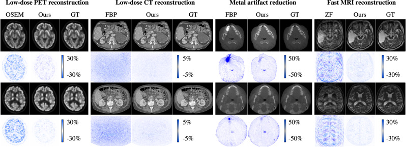 A generalized dual-domain generative framework with hierarchical ...