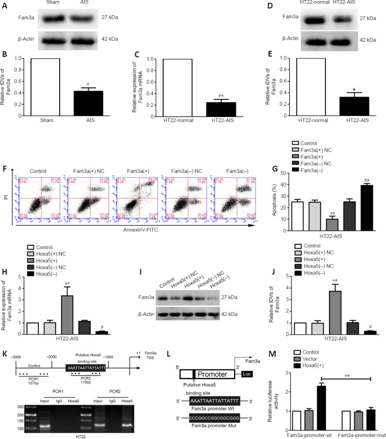 The circular RNA Rap1b promotes Hoxa5 transcription by recruiting Kat7 ... The circular RNA Rap1b promotes Hoxa5 transcription by recruiting Kat7 ...