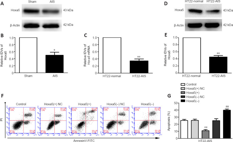 The circular RNA Rap1b promotes Hoxa5 transcription by recruiting Kat7 ... The circular RNA Rap1b promotes Hoxa5 transcription by recruiting Kat7 ...