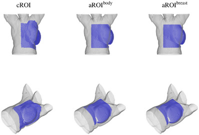 Development of automated region of interest selection algorithms for surface‐guided radiation ...