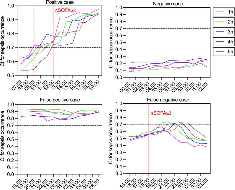 Transferability and interpretability of the sepsis prediction models in ...