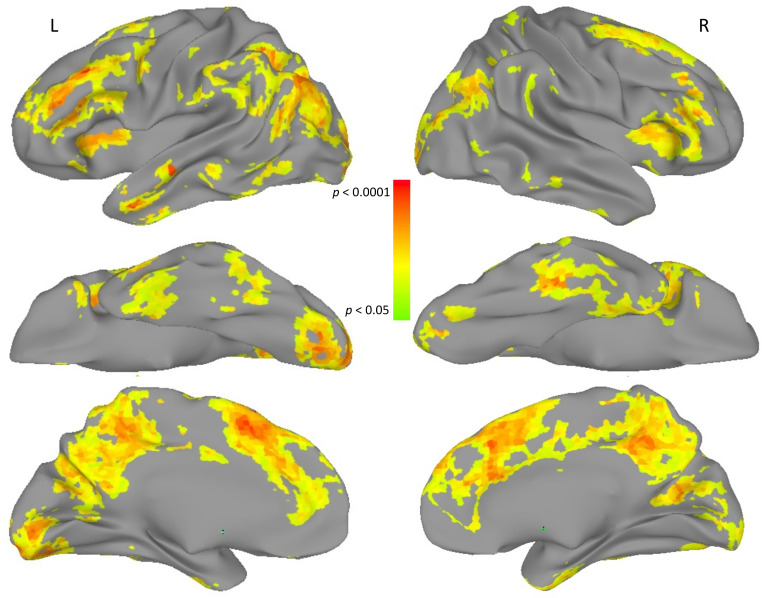 An inclusive multivariate approach to neural localization of language components - PMC