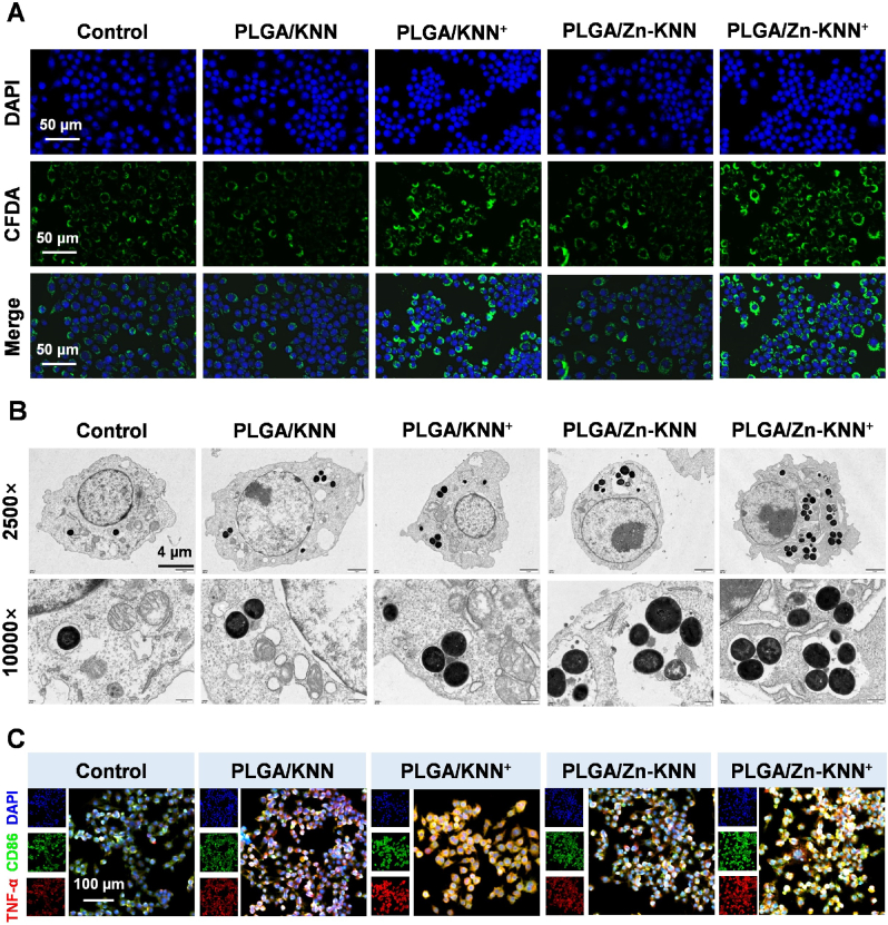 An ultrasound-driven PLGA/Zn-KNN hybrid piezoelectric scaffold with direct and immunoregulatory ...