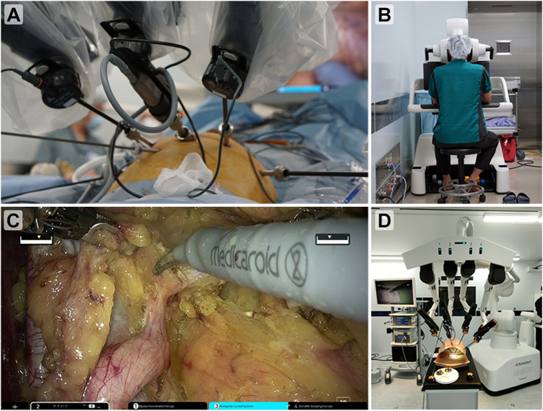 Robotic urologic applications of the hinotori™ Surgical Robot System - PMC