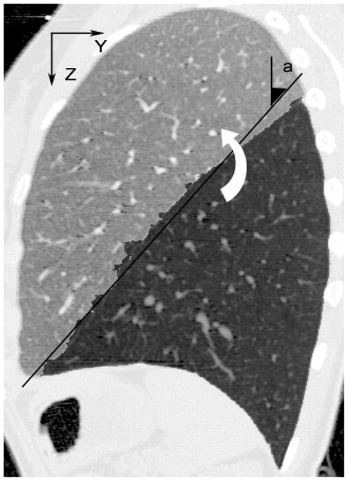 Anatomy-guided lung lobe segmentation in X-ray CT images - PMC