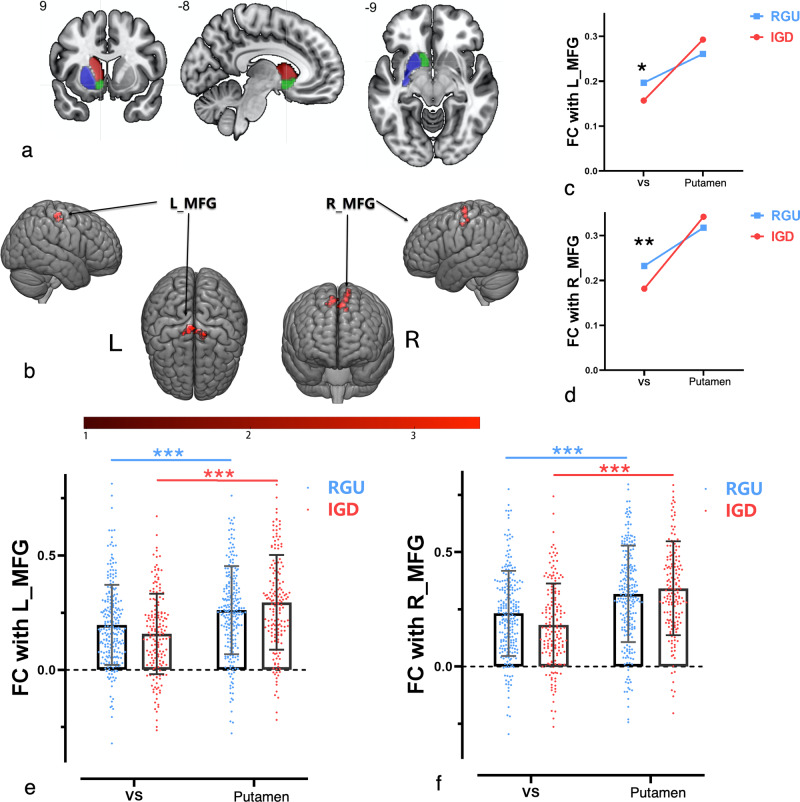 Dorsal and ventral striatal functional connectivity shifts play a potential role in internet ...