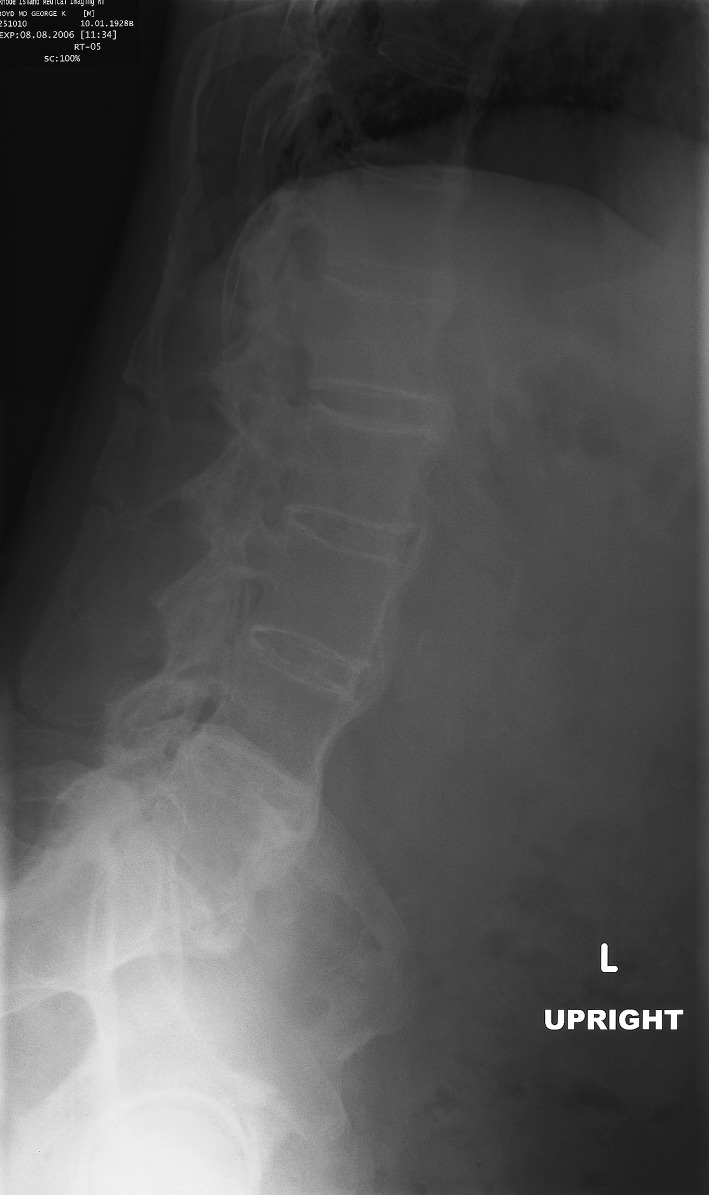 Self Assessment Questions - PMC