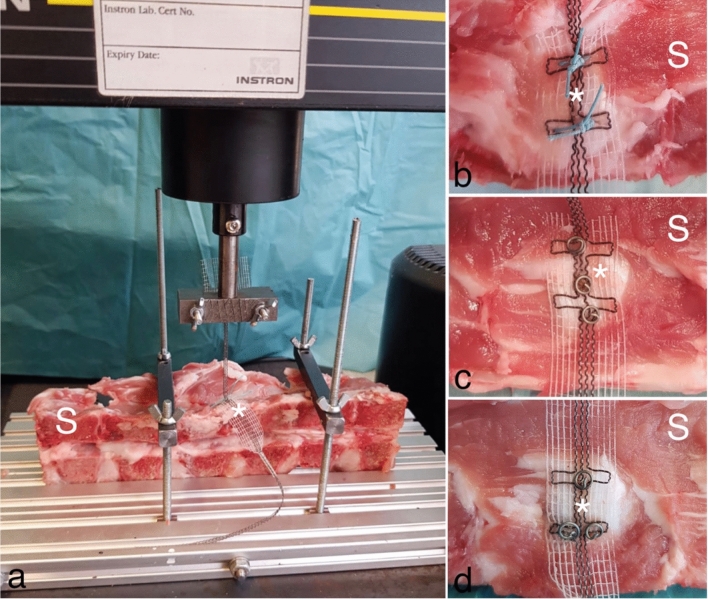 Tacks vs. sutures: a biomechanical analysis of sacral bony fixation methods for laparoscopic ...