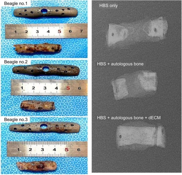 Bone Regeneration with 3D-Printed Hybrid Bone Scaffolds in a Canine Radial Bone Defect Model - PMC