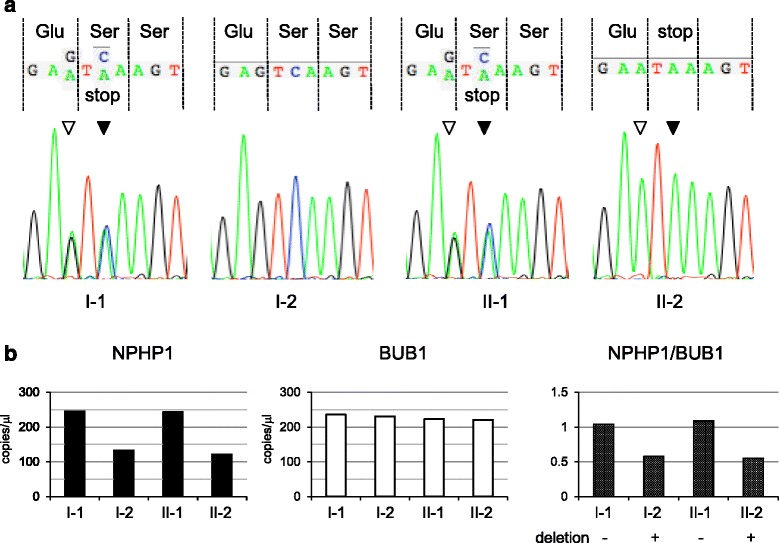 Whole-exome sequencing and digital PCR identified a novel compound heterozygous mutation in the ...