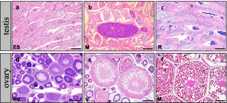 Comparative Transcriptomic Analysis Of Gonadal Development And Renewal