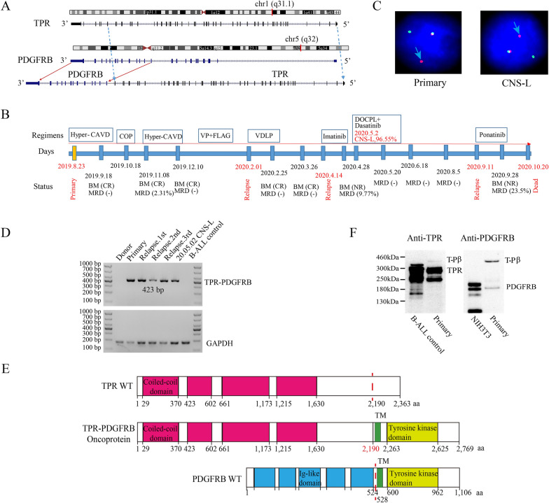 Single-cell heterogeneity and dynamic evolution of Ph-like acute lymphoblastic leukemia patient ...