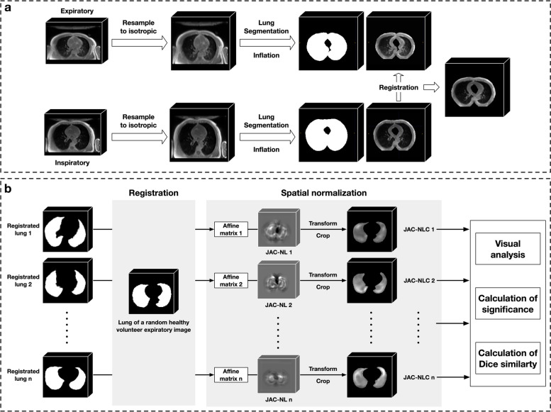 Assessment of lung deformation in patients with idiopathic pulmonary fibrosis with elastic ...