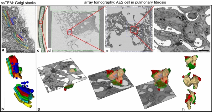 Volume electron microscopy: analyzing the lung - PMC