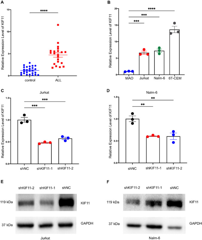 KIF11 serves as a cell cycle mediator in childhood acute lymphoblastic ...
