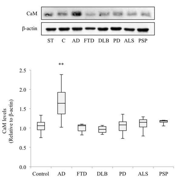 Calmodulin levels in blood cells as a potential biomarker of Alzheimer’s disease - PMC