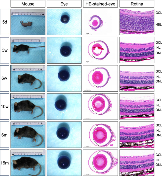 Integrated Transcriptome Analysis of Long Noncoding RNA and mRNA in ...
