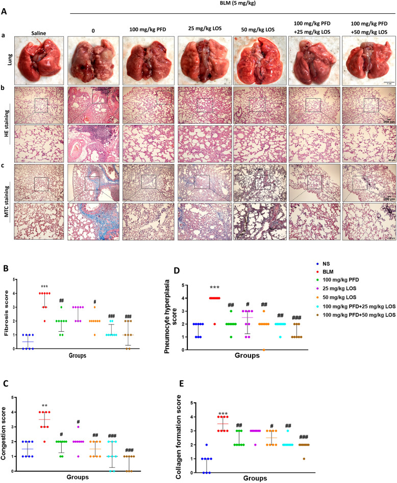 Combination of losartan with pirfenidone: a protective anti-fibrotic against pulmonary fibrosis ...