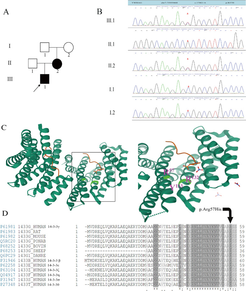 A heterozygous missense variant in the YWHAG gene causing developmental and epileptic ...