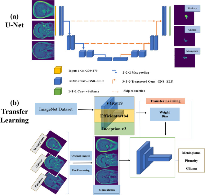 T1-weighted MRI-based brain tumor classification using hybrid deep learning models - PMC