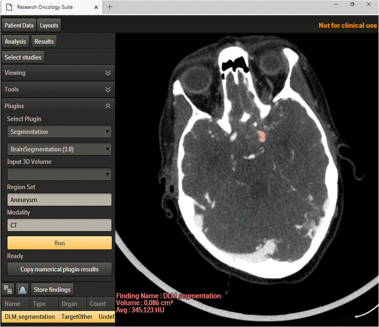 Deep learning assistance increases the detection sensitivity of radiologists for secondary ...