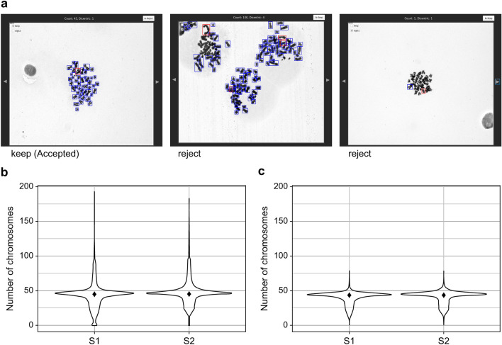 Dicentric chromosome assay using a deep learning-based automated system - PMC
