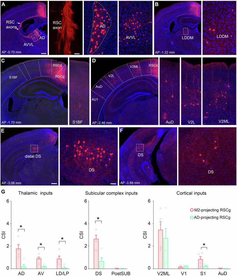 Projection Specific Circuits Of Retrosplenial Cortex With Differential Contributions To Spatial