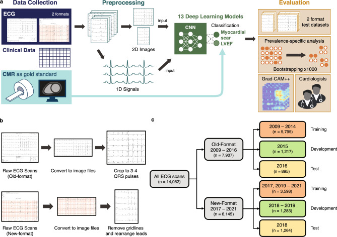 Myocardial scar and left ventricular ejection fraction classification for electrocardiography ...