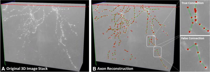 DeepNeuron: an open deep learning toolbox for neuron tracing - PMC