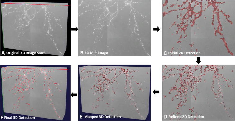 DeepNeuron: an open deep learning toolbox for neuron tracing - PMC