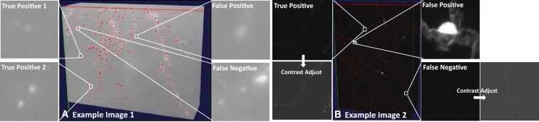 DeepNeuron: an open deep learning toolbox for neuron tracing - PMC