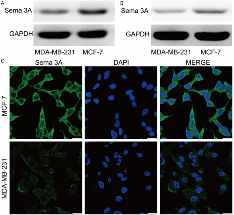 Breast cancer cells promote osteoblastic differentiation via Sema 3A ...