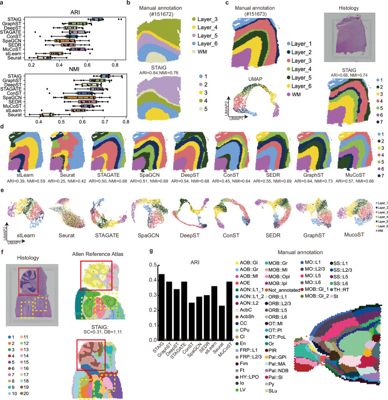 STAIG: Spatial transcriptomics analysis via image-aided graph contrastive learning for domain ...