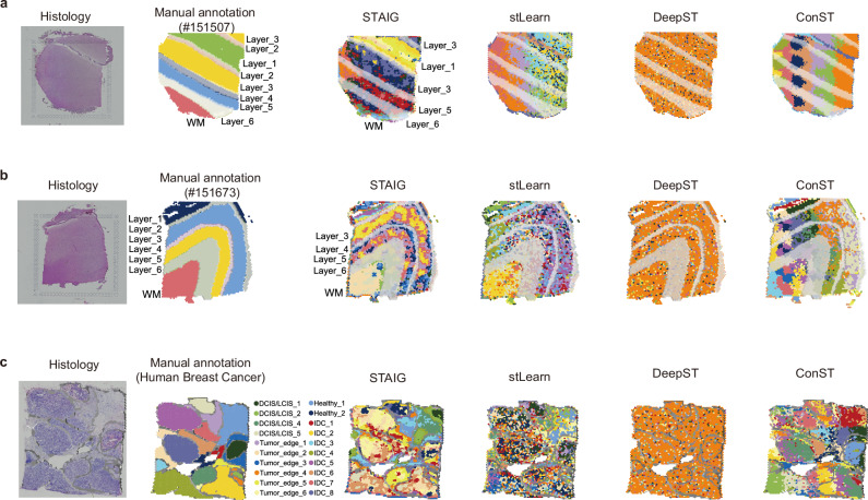 STAIG: Spatial transcriptomics analysis via image-aided graph contrastive learning for domain ...