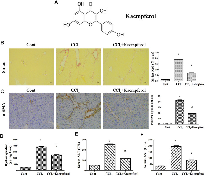 Kaempferol Inhibits Hepatic Stellate Cell Activation by Regulating miR ... Kaempferol Inhibits Hepatic Stellate Cell Activation by Regulating miR ...