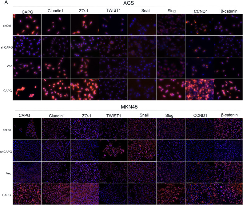 CAPG is a novel biomarker for early gastric cancer and is involved in ...